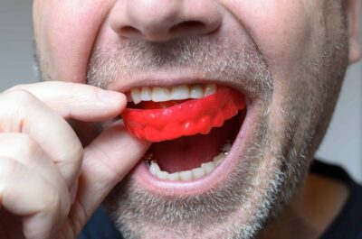 Teeth Grinding: The Dangers, Causes, and Solutions — Anne Cohen Writes
